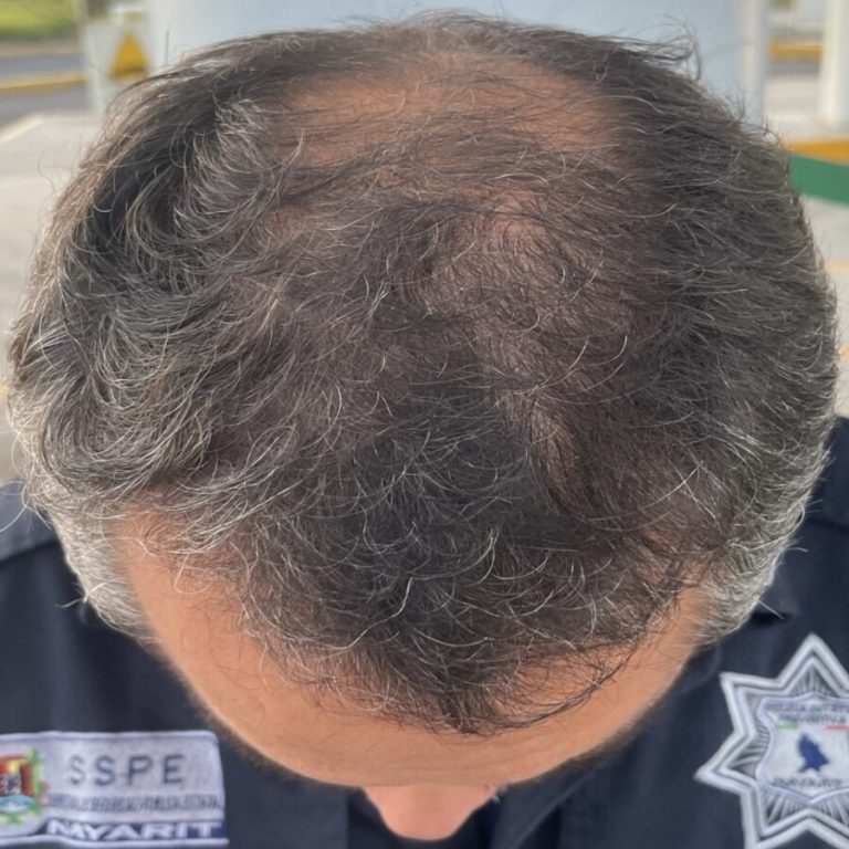 HMT Hospital Mexicano de Tricología